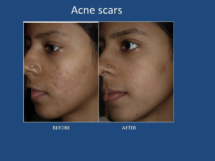 Chronic Urticaria Advanced management Chronic Eczema Patch testing