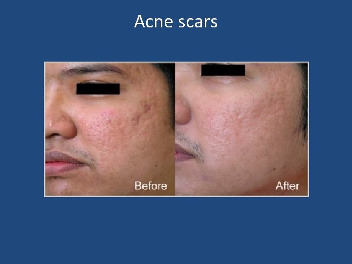 Chronic Urticaria Advanced management Chronic Eczema Patch testing