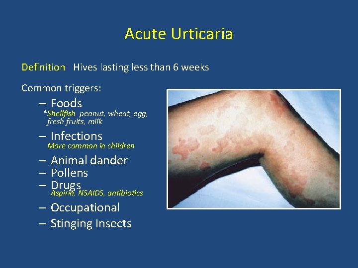 Chronic Urticaria Advanced management Chronic Eczema Patch testing