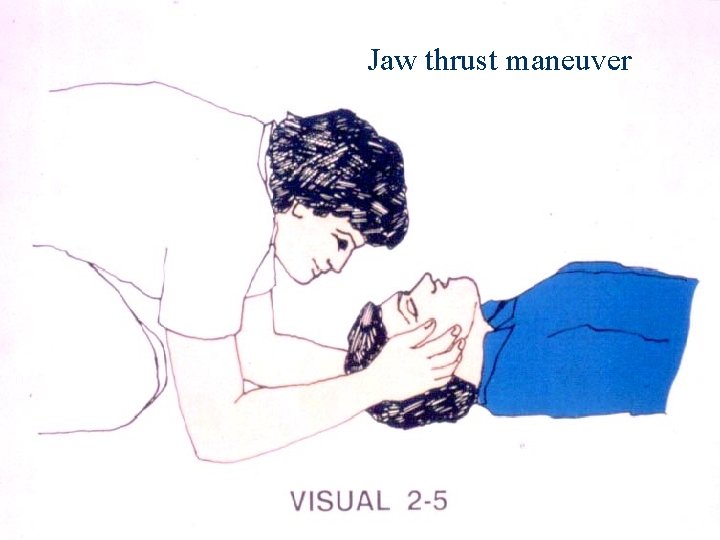 CHAPTER 2 Artificial Ventilation Chapter 2 Artificial Ventilation