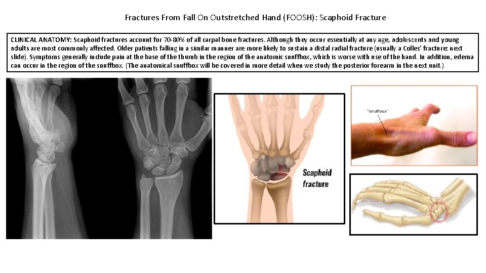 Power Point Handout Lab 11 Anterior Forearm Palmar