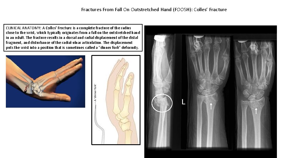 Power Point Handout Lab 11 Anterior Forearm Palmar