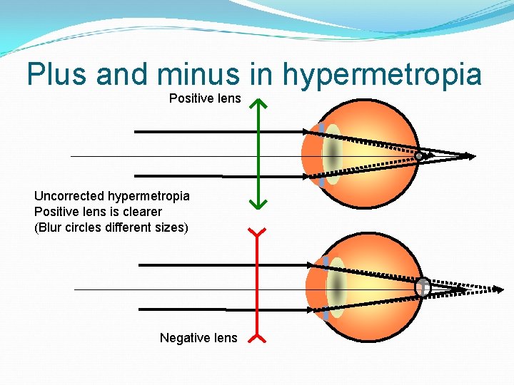 Subjective refraction OP 1201 Basic Clinical Techniques Spherical