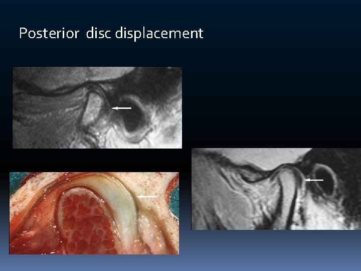 THE TEMPROMANDIBULAR JOINT TMJ By NourEldin A NourEldin