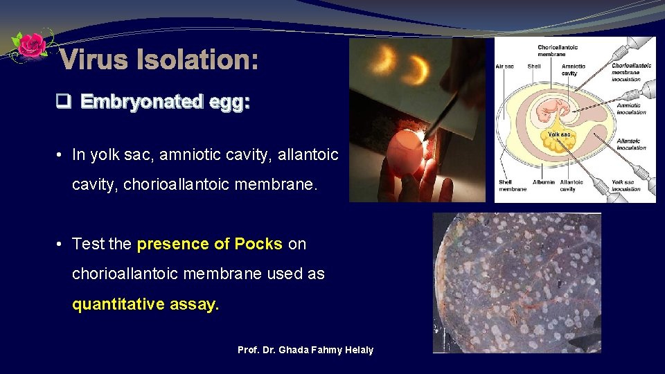 Prof Dr Ghada Fahmy Helaly GENERAL VIROLOGY DIAGNOSIS