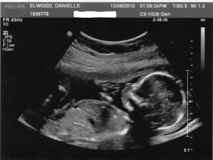 Affordable Ultrasounds By Dino De Salvio How it