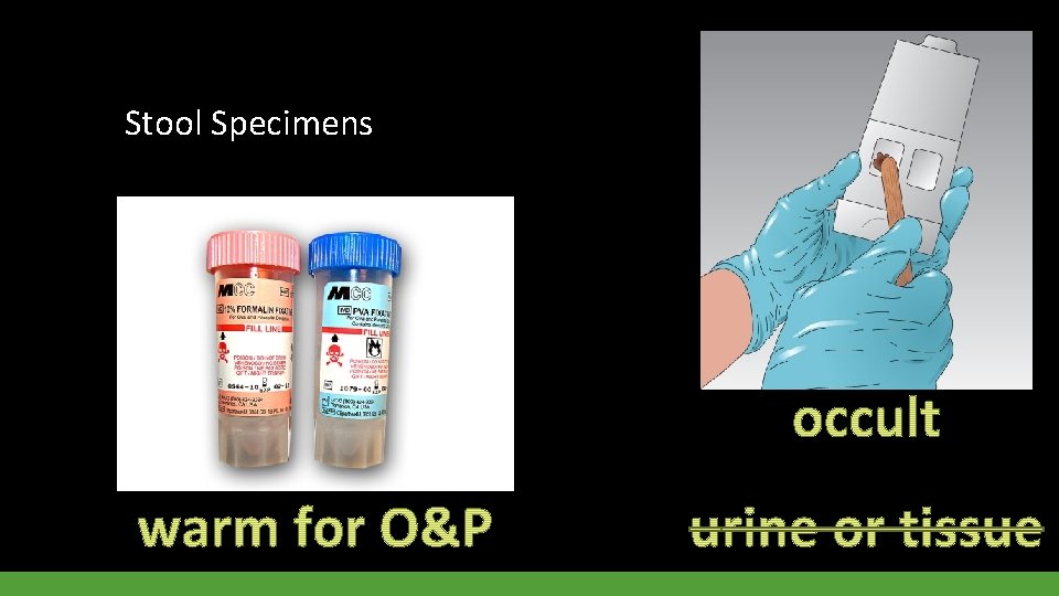 Bowel Elimination CHAPTER 17 Learning Objectives List qualities