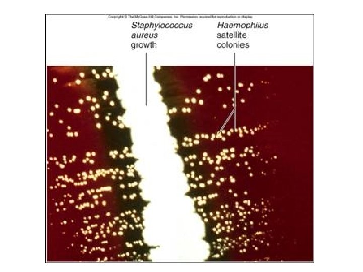 Haemophilus influenzae Most Common Species of Haemophilus Haemophilus