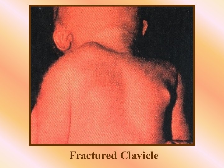 Common Neonatal Problems Mohamed Khashaba MD Professor of