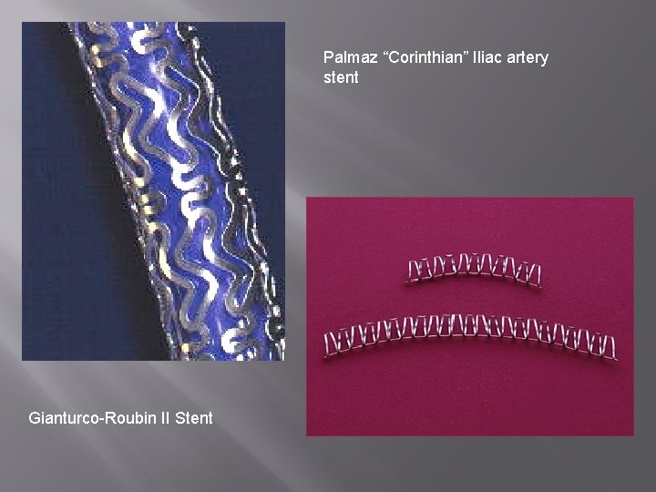 BIOPOLYMER PROCESSING IN MEDICAL APPLICATION AS VASCULAR STENTS