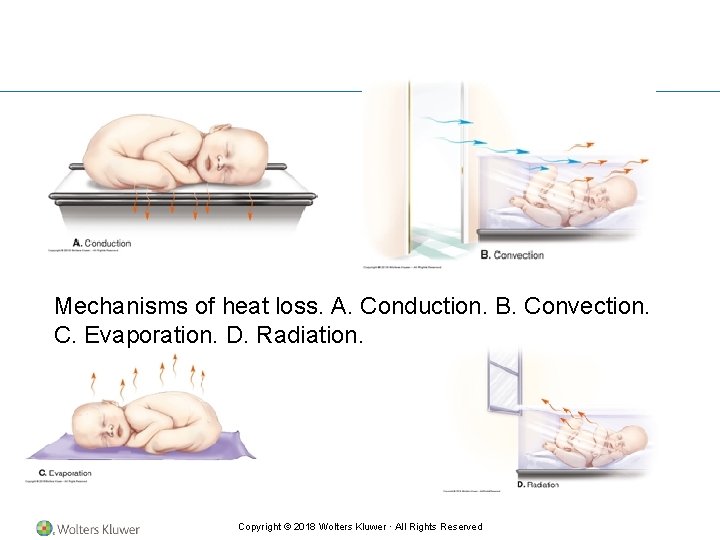 Chapter 13 Nursing Care During Newborn Transition Copyright