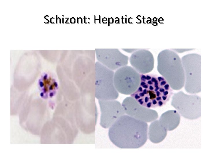 MALARIA INTRODUCTION CAUSES 1 3 MILLION DEATHS A