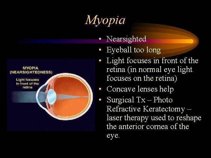 EYE STRUCTURE and VISION GENERAL FACTS ABOUT THE