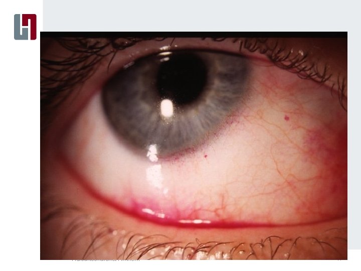 Het rode oog Achter het NTS 2017 LEERDOELEN