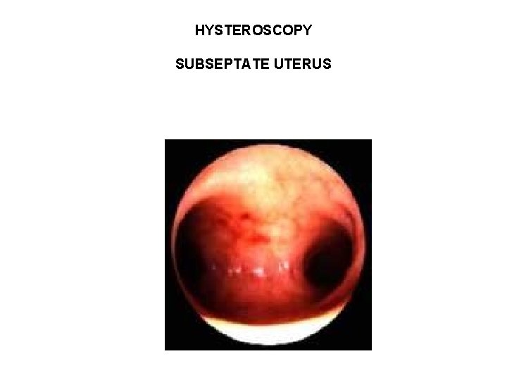GENERAL GYNECOLOGY CONGENITAL MALFORMATIONS OF THE FEMALE GENITAL