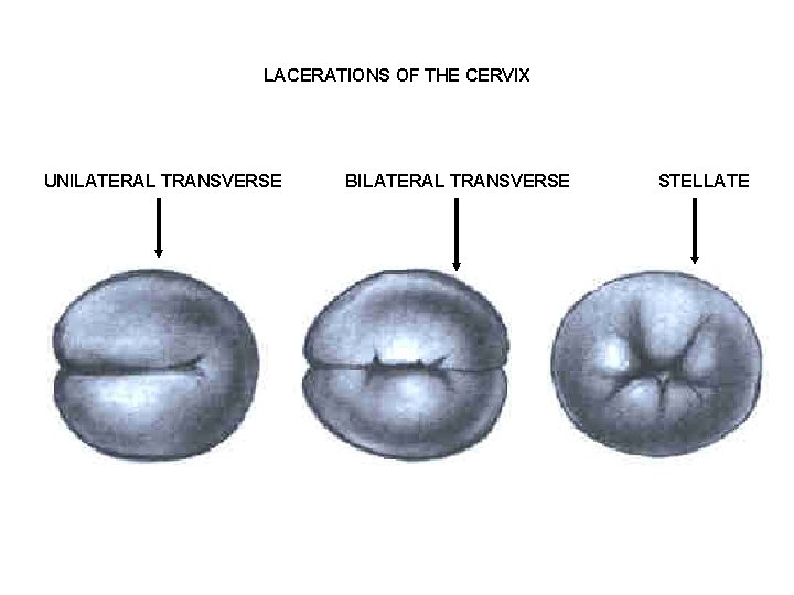 GENERAL GYNECOLOGY CONGENITAL MALFORMATIONS OF THE FEMALE GENITAL