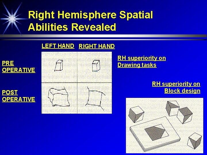 Last Lecture History of disconnection syndromes The structure