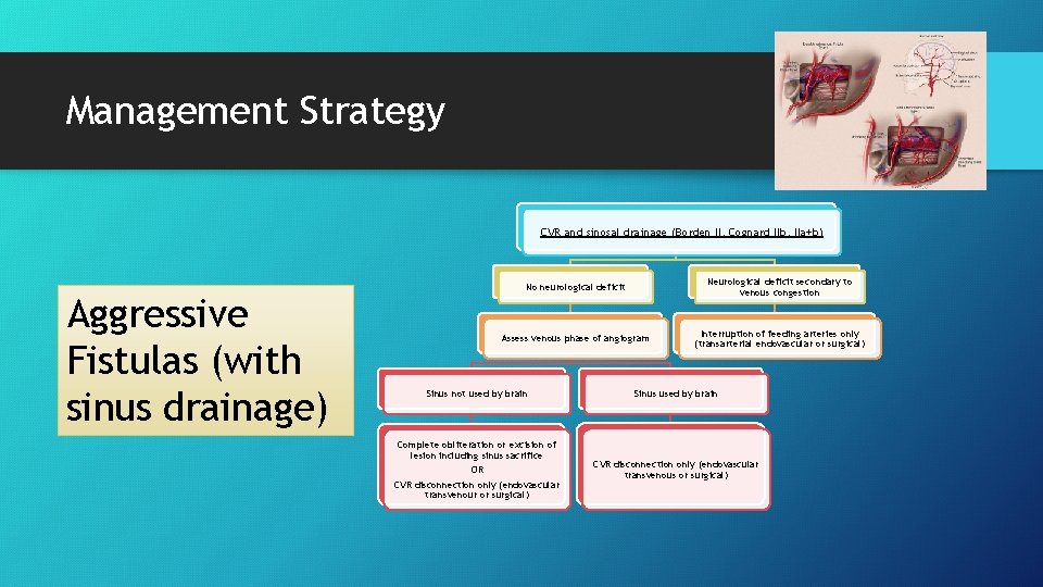 Definition Abnormal arteriovenous shunts within the dural leaflets