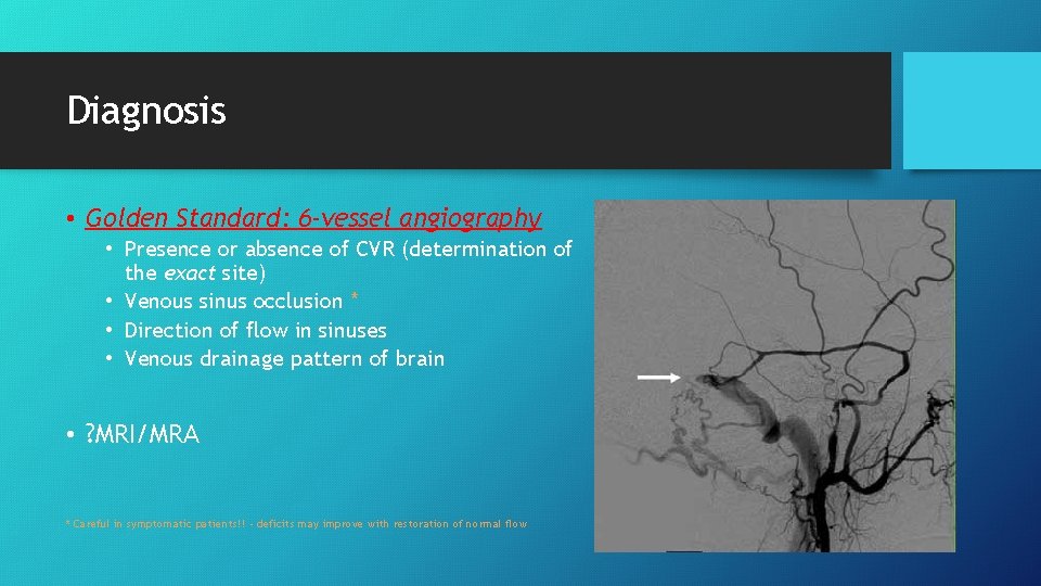 Definition Abnormal arteriovenous shunts within the dural leaflets
