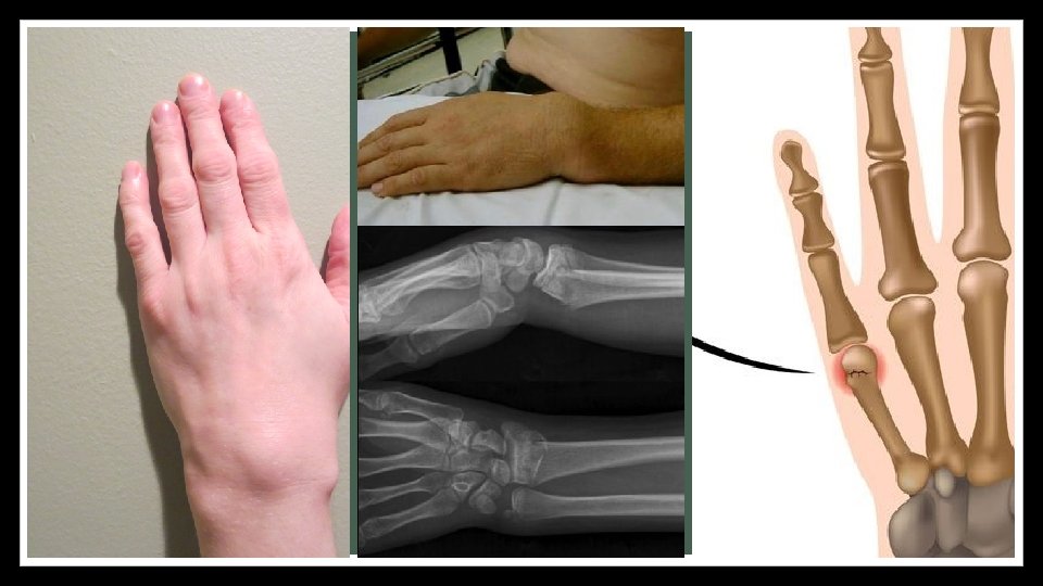 CHAPTER 12 WRIST HAND INJURIES Unit 4 Understanding