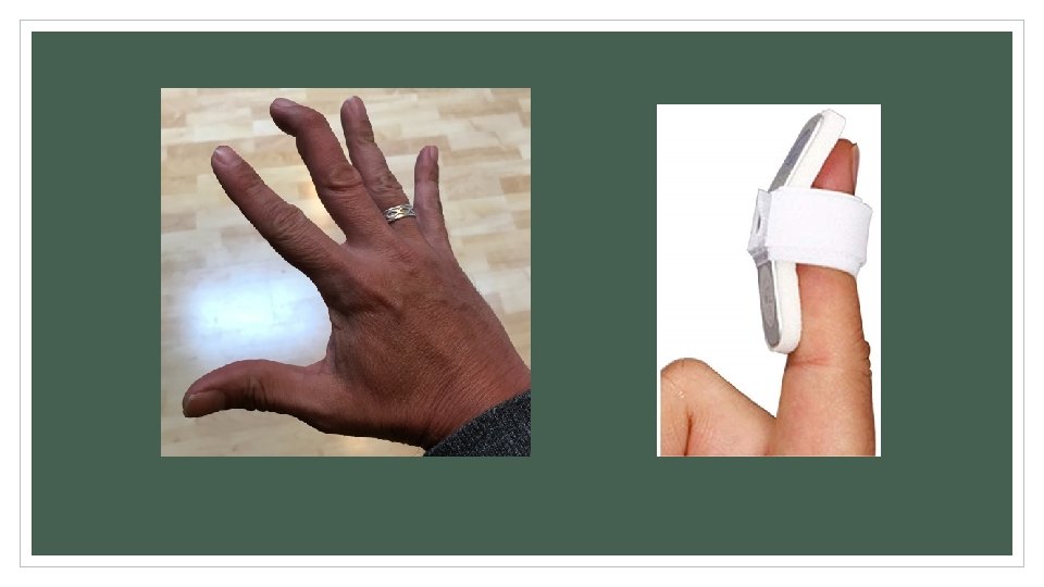 CHAPTER 12 WRIST HAND INJURIES Unit 4 Understanding