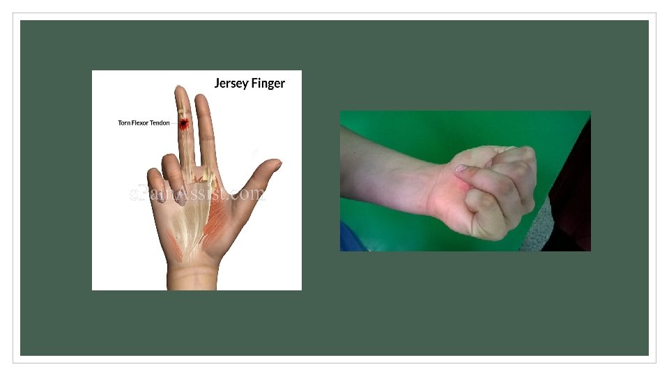 CHAPTER 12 WRIST HAND INJURIES Unit 4 Understanding