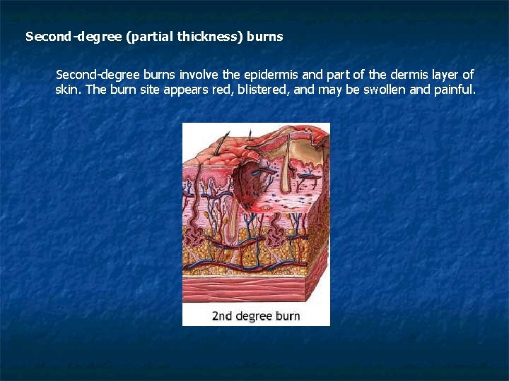 Activity 5 1 2 Burn Unit Treatment Options