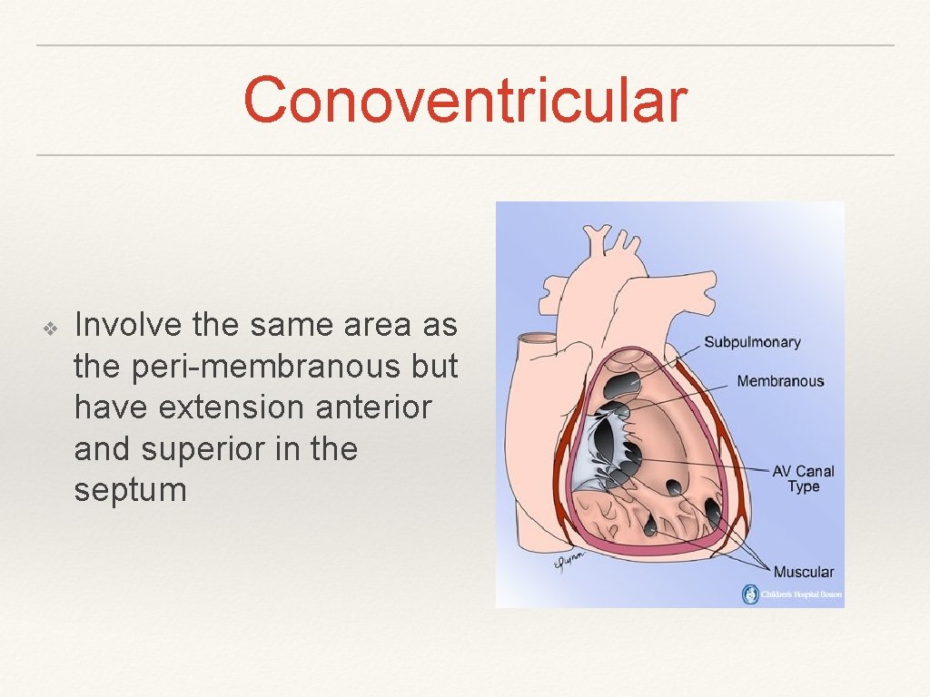 UCSF Congenital Cardiac Anesthesia Tutorials VSDs and ASDs