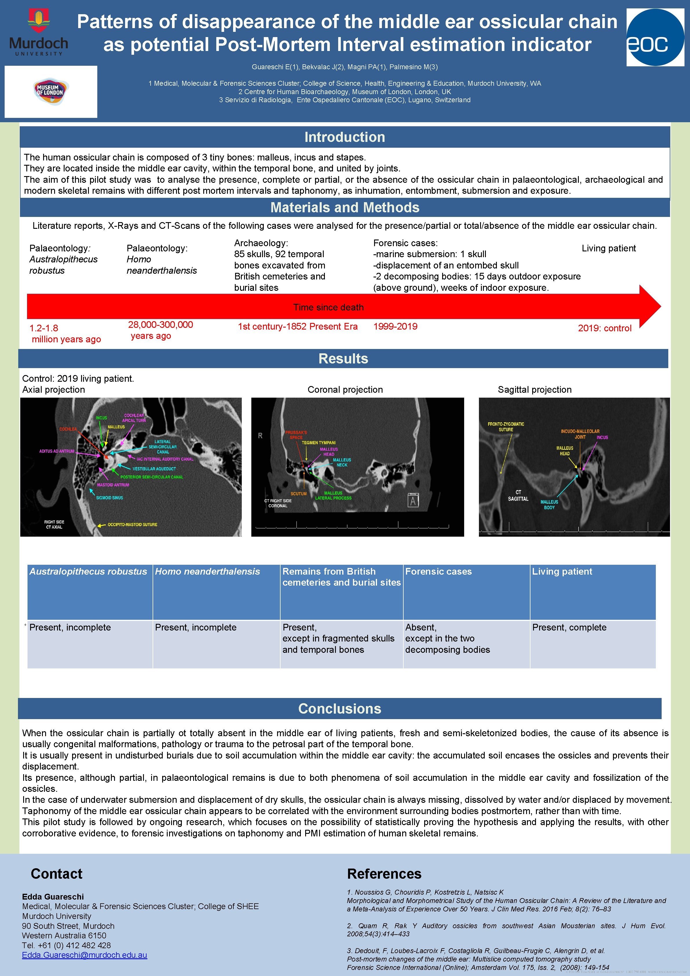 Patterns of disappearance of the middle ear ossicular