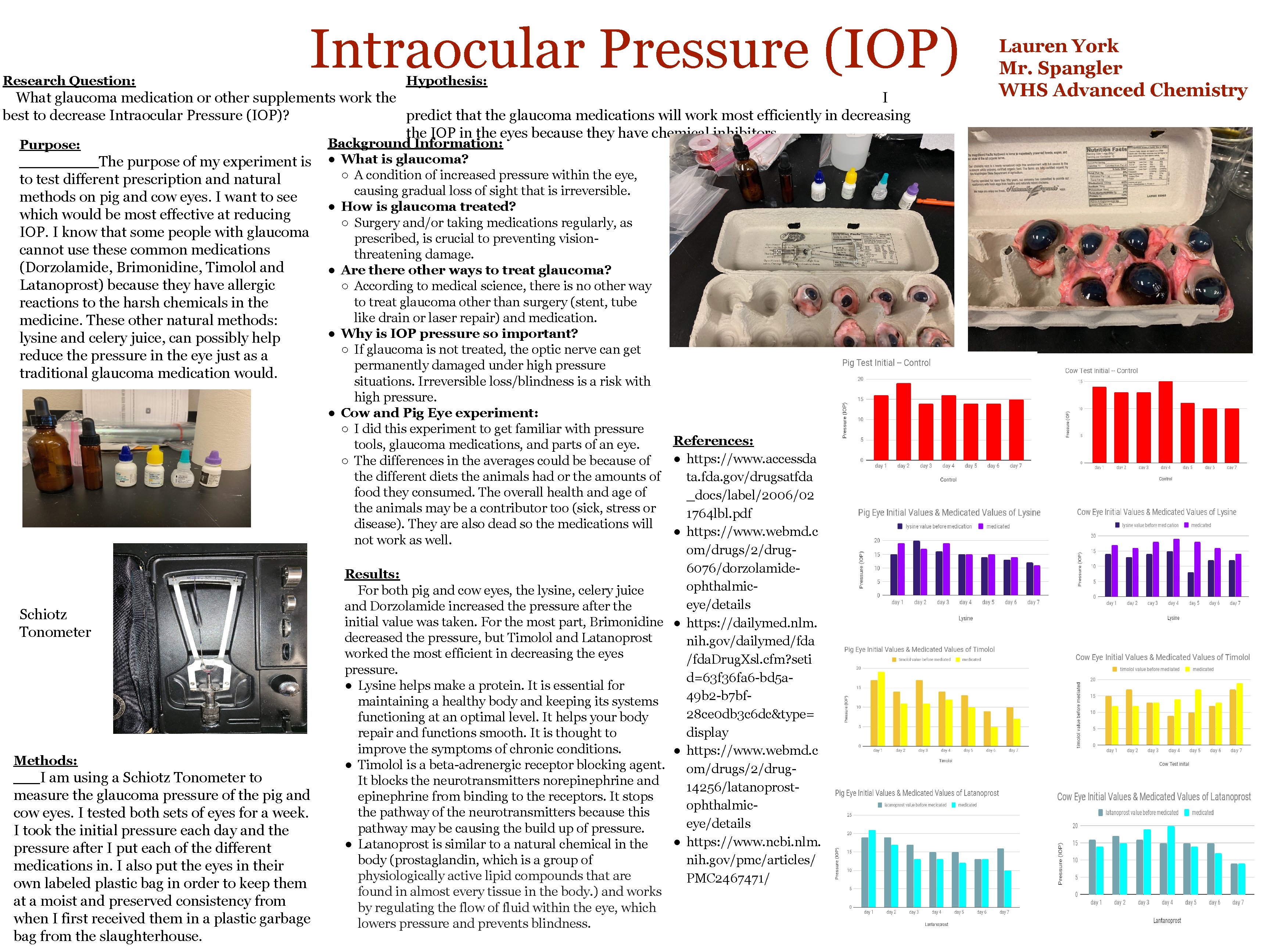 Research Question Intraocular Pressure IOP Hypothesis I What