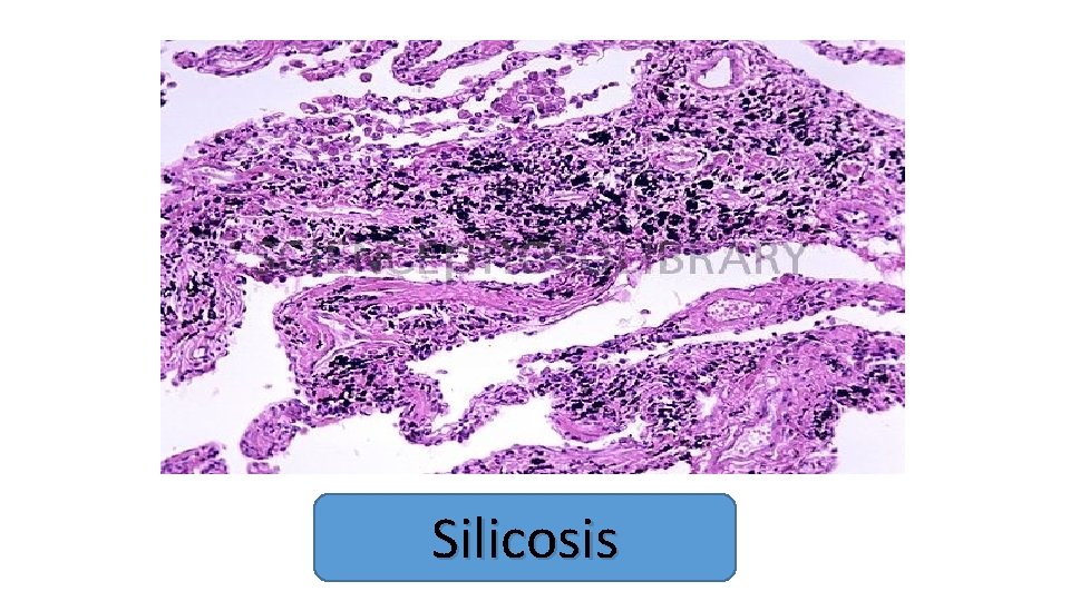 Practical histopathology Lab 10Handling and Evaluation of lung