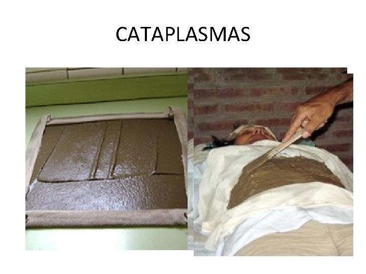 GEOTERAPIA CATAPLASMAS ENTERRAMIENTOS La obra mdicomisionera est todava