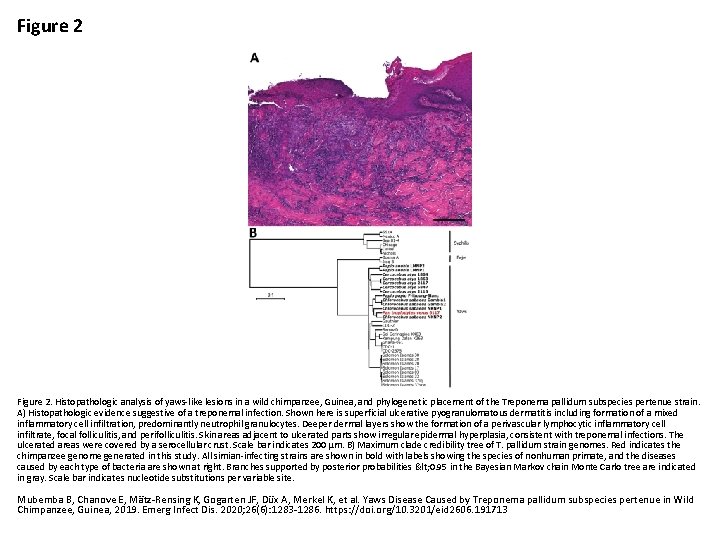 Figure 2 Histopathologic analysis of yawslike lesions in