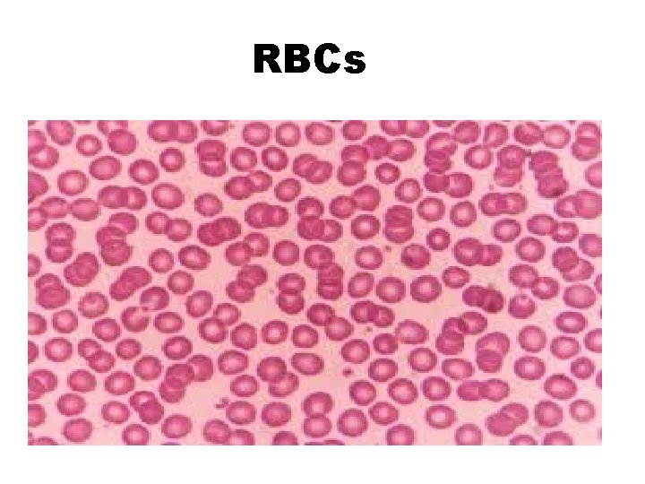 Blood smear RBCs RBCs q subplasmalemmal cytoskeleton actin