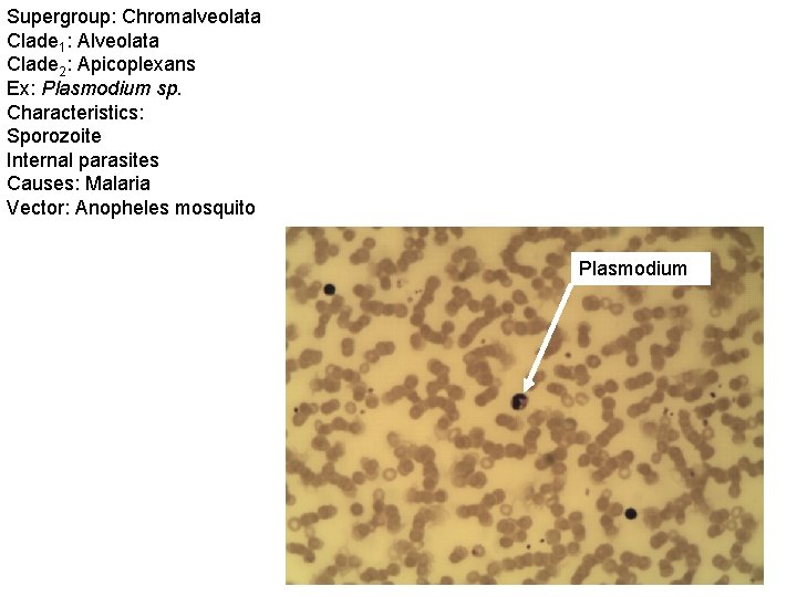 Supergroup Excavata Clade Diplomonads Ex Giardia lamblia Characteristics