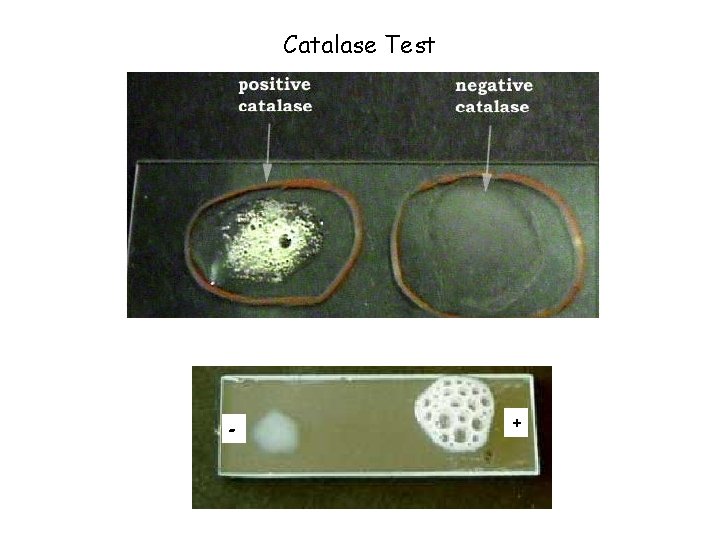 Lab Exercise 14 Biochemical Differentiation of some Medically