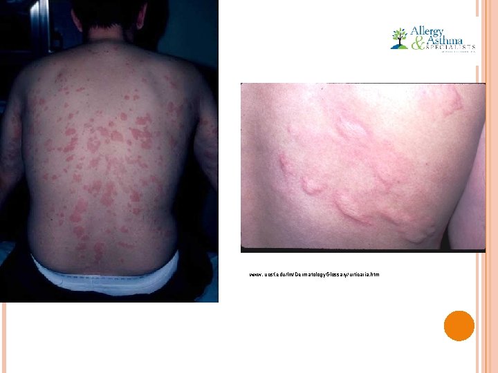 Current Approaches to the Diagnosis and Management of