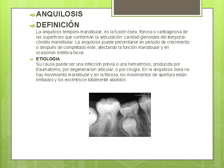 patologas ms frecuentes del aparato estomatogntico PERIODONTITIS DEFINICIN