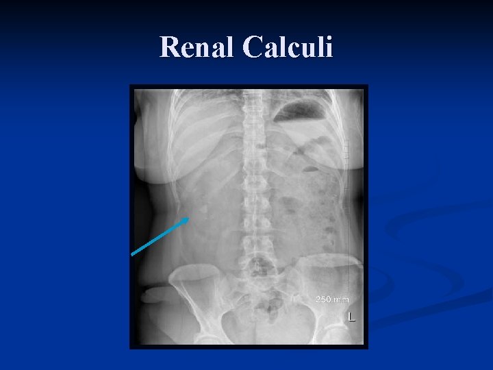 RADIOLOGY REVIEW Plain films of abdomen ABDOMEN Soft