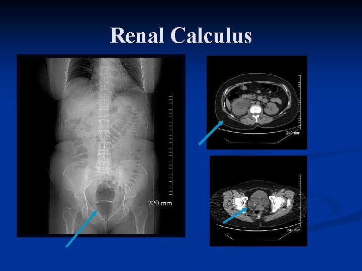 RADIOLOGY REVIEW Plain films of abdomen ABDOMEN Soft