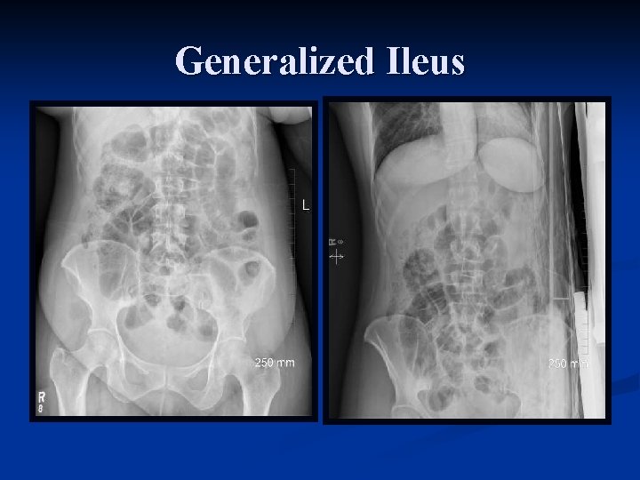 RADIOLOGY REVIEW Plain films of abdomen ABDOMEN Soft