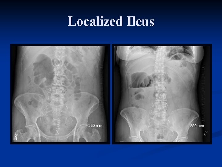 RADIOLOGY REVIEW Plain films of abdomen ABDOMEN Soft