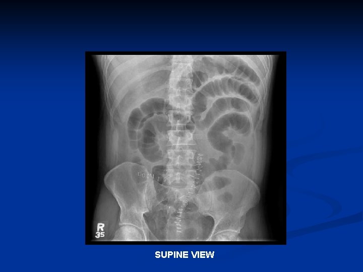 RADIOLOGY REVIEW Plain films of abdomen ABDOMEN Soft