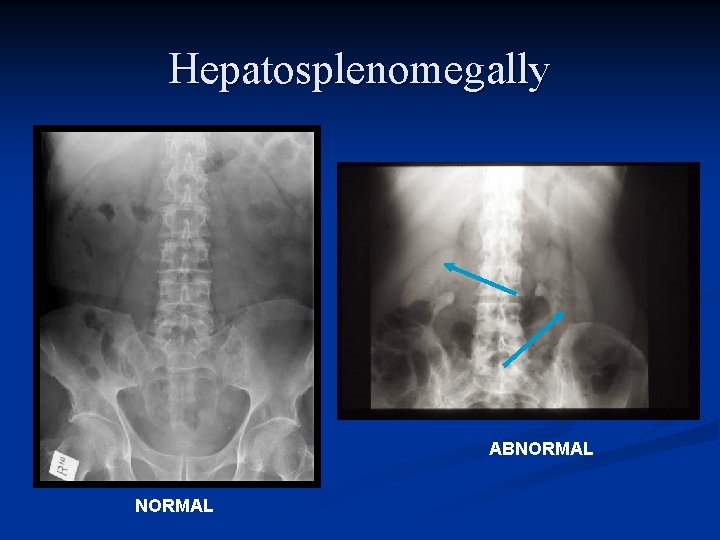 RADIOLOGY REVIEW Plain films of abdomen ABDOMEN Soft