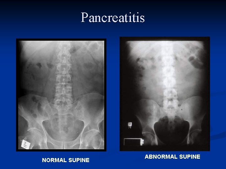 RADIOLOGY REVIEW Plain films of abdomen ABDOMEN Soft