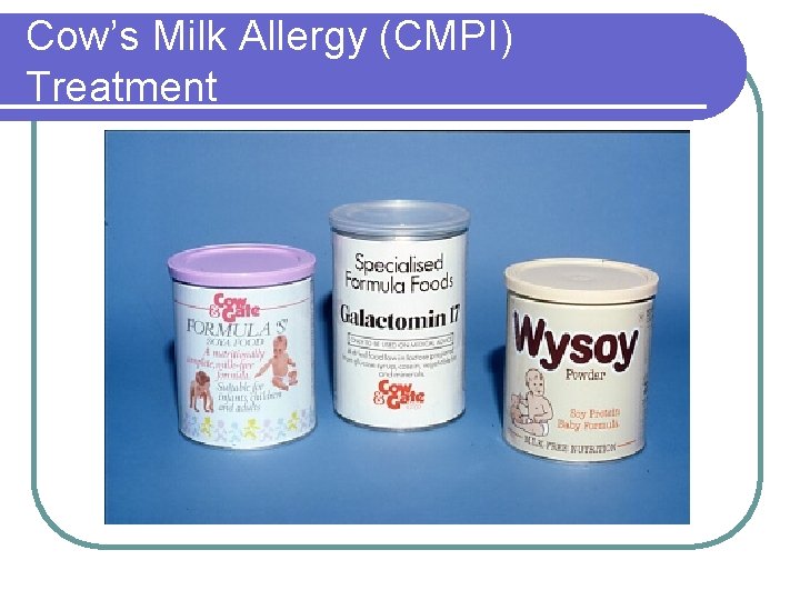Causes and Investigation of Malabsorption in Childhood Definition