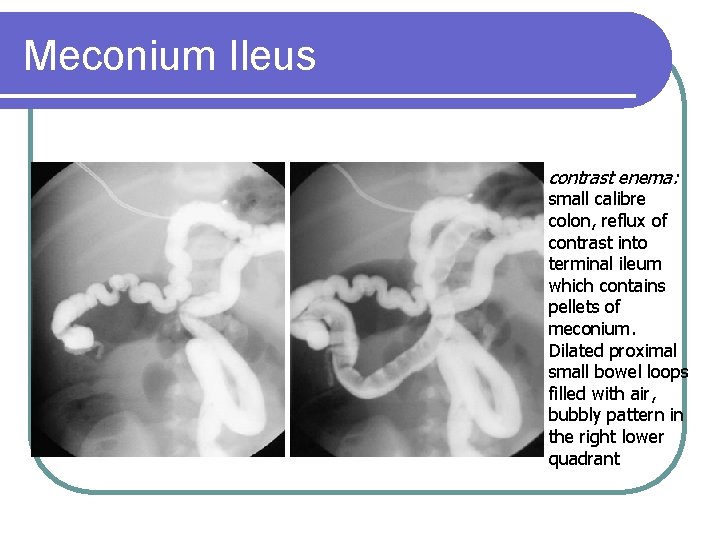 Causes and Investigation of Malabsorption in Childhood Definition