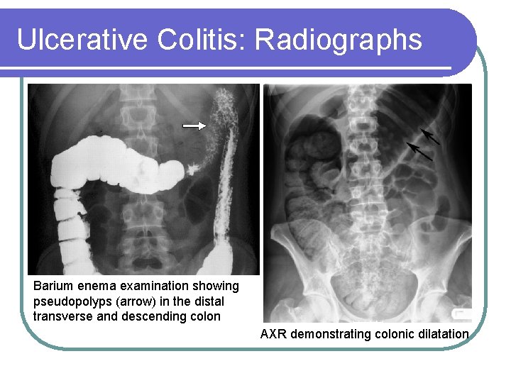 Causes and Investigation of Malabsorption in Childhood Definition