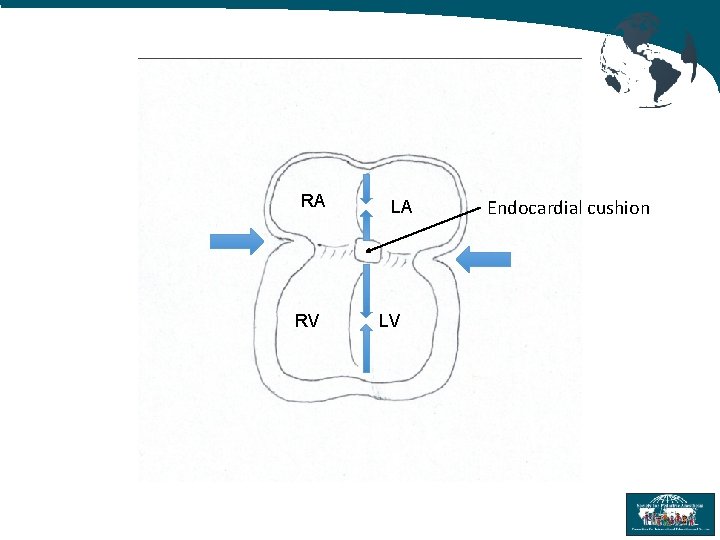Neonatal Cardiovascular Physiology Greg Latham MD Associate Professor