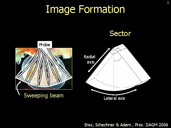 1 Ultrasound Image Denoising by Spatially Varying Frequency